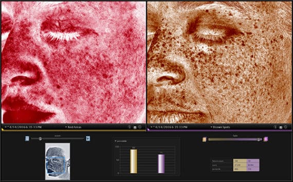 VISIA Skin Analysis | Virginia, Washington D.C. and Maryland