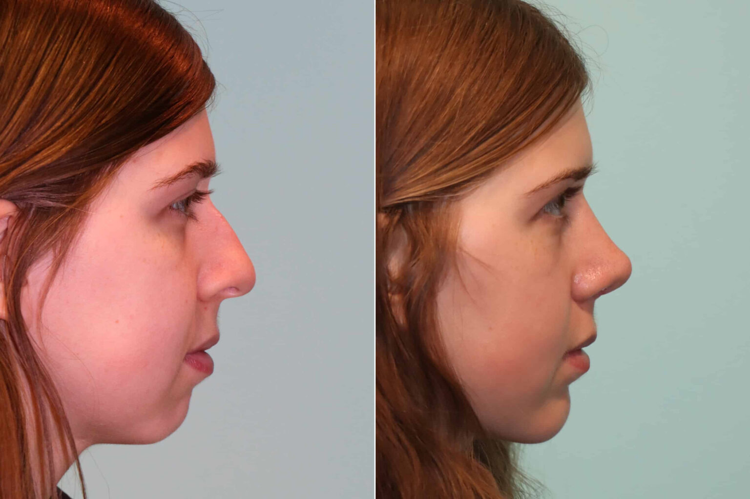 Why Patients Are Choosing Facial Harmony | The Naderi Center